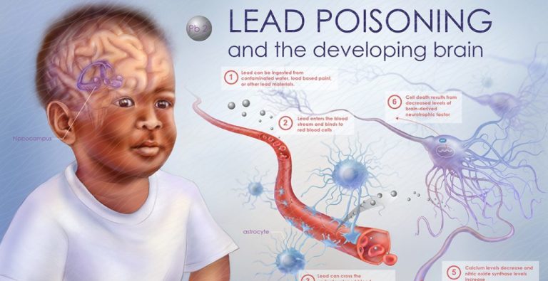 Oakland Child Lead Exposure Worse Than Flint, Michigan, Study Finds ...